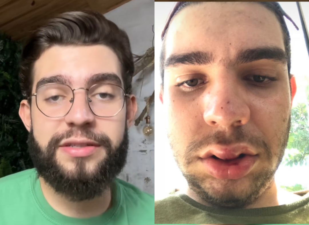 Ramon Vitor retorna à internet e revela que apanhou e foi extorquido pelo irmão por ser gay | Pheeno